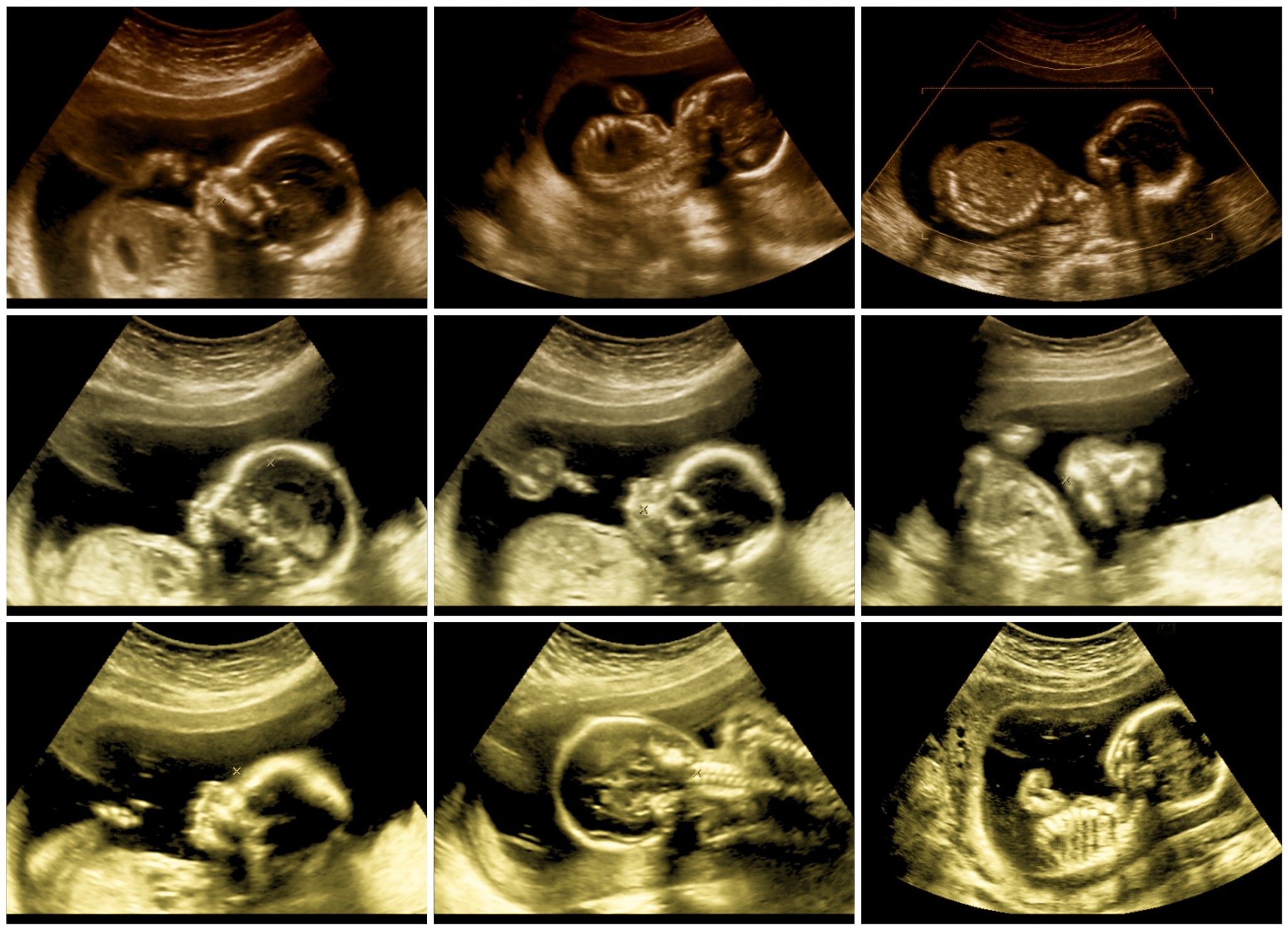 From the Fetus, the Child « News# « Cambridge Core Blog