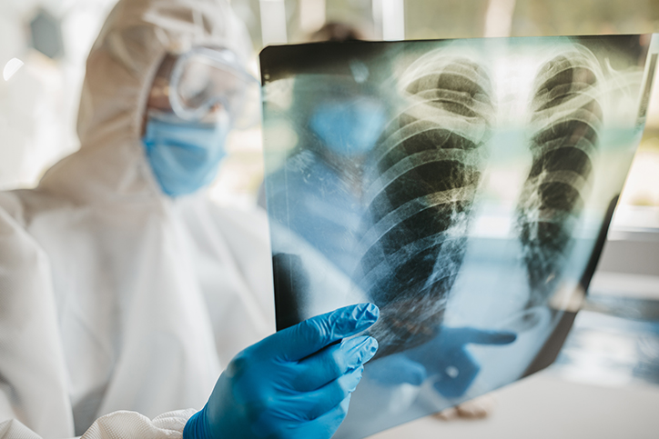 How to diagnose pneumonia | Cambridge University Press